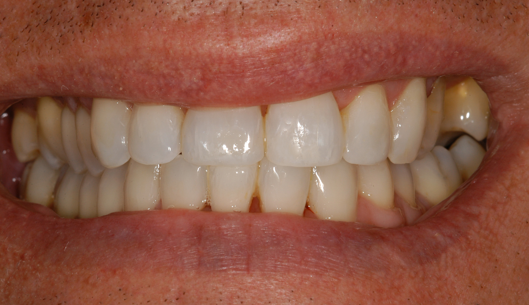 How cosmetic dentistry can change your smile | Comparethetreatment.com