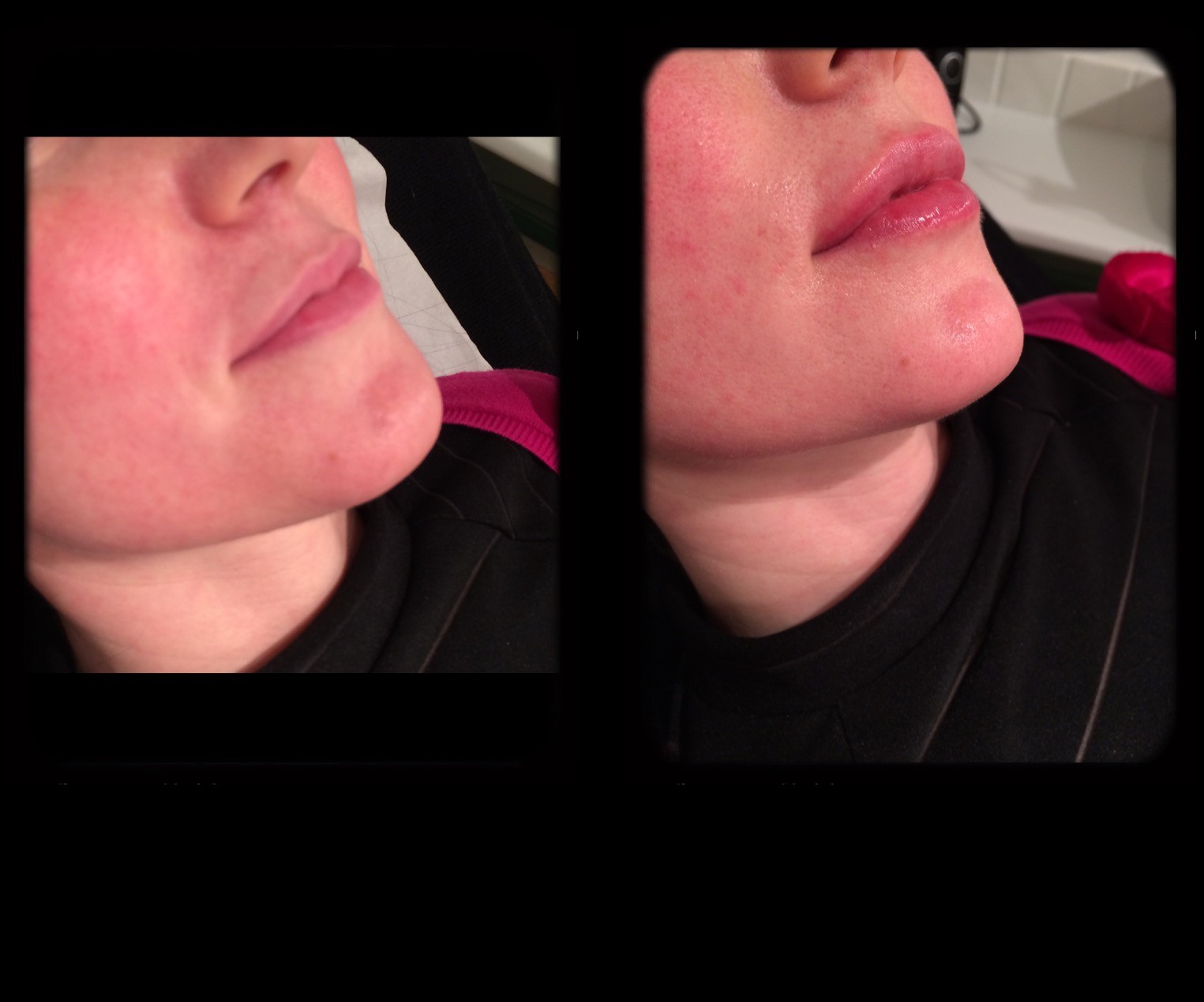 Carly Pearce Aesthetics interview | Comparethetreatment.com